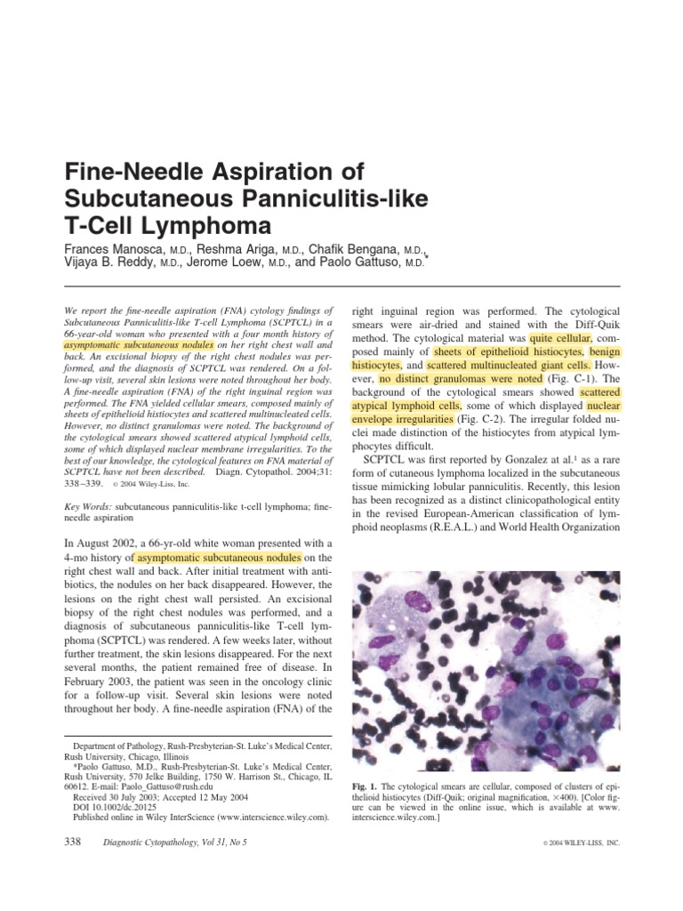 FNA Findings in Subcutaneous T-Cell Lymphoma | PDF | Cytopathology ...