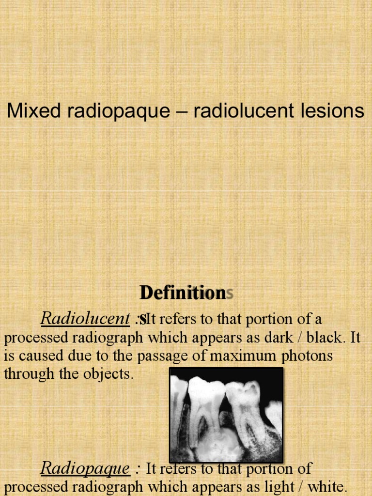 Mixed Lesions Imaging | PDF | Tooth | Anatomy