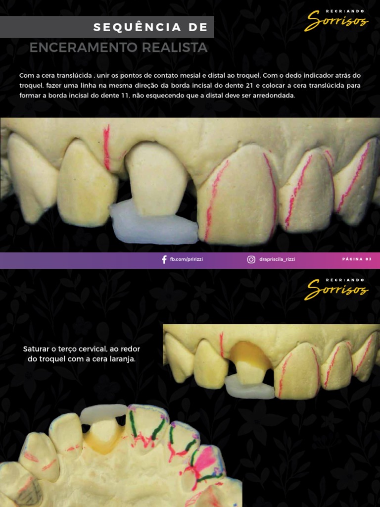 Ebook Passo para Enceramento Anterior Priscila Rizzi | PDF | Dentina ...