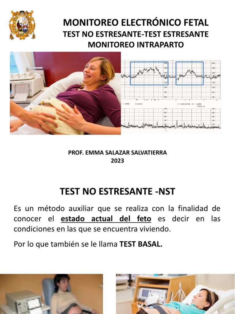 Monitoreo Electrónico Fetal Test No Estresante-Test Estresante ...