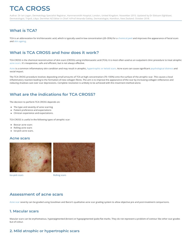 Tca Cross - Dermnet | Download Free PDF | Scar | Medicine