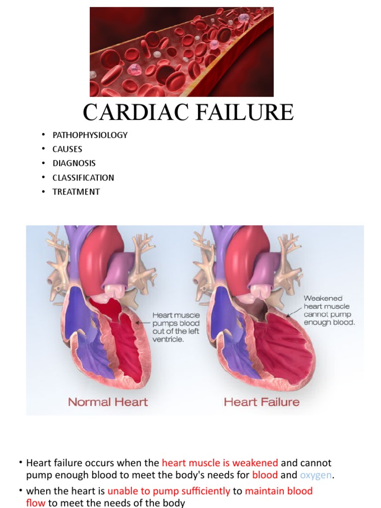 3.cardiac Failure | PDF | Heart Failure | Heart