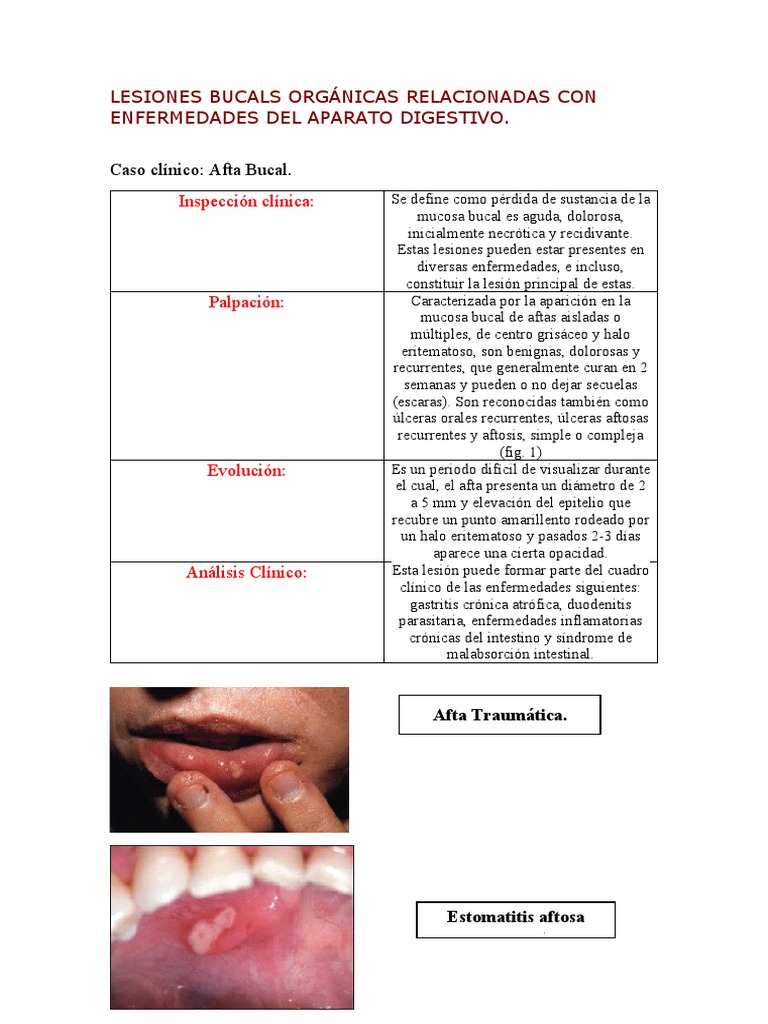 Caso Clinico Afta Bucal Cesar Atarama | PDF | Condiciones cutáneas ...