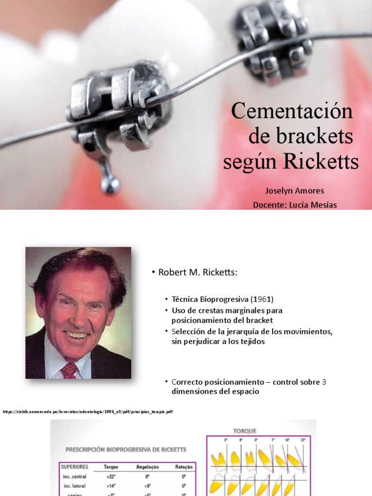 Cementación de Brackets Según Ricketts | PDF