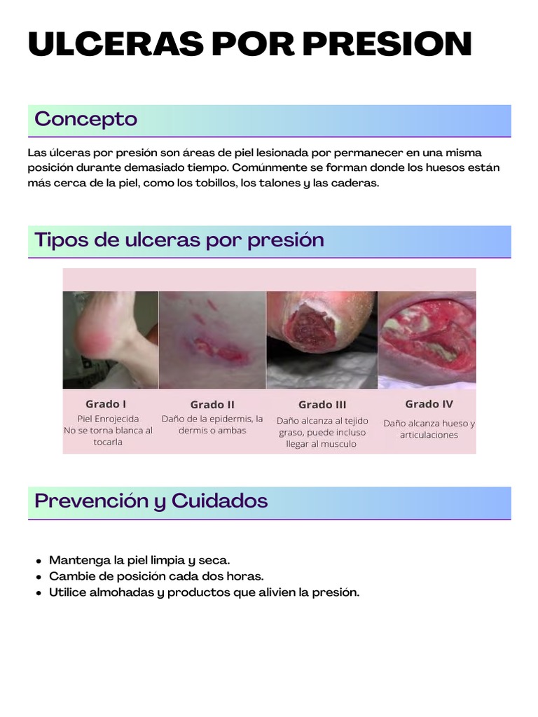Tipos y Cuidados de Úlceras por Presión | PDF