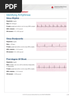 Basic EKG Interpretation Exam Answers | PDF | Electrocardiography ...