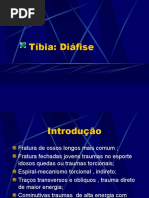 Técnica Cirúrgica: Haste Intramedular Tíbia | PDF | Joelho