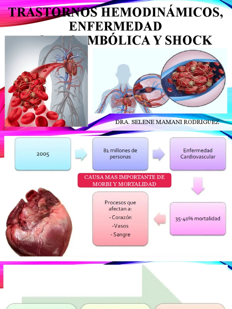Trastornos Hemodinámicos, Enfermedad Tromboembólica y Shock | PDF | Plaqueta | Inflamación