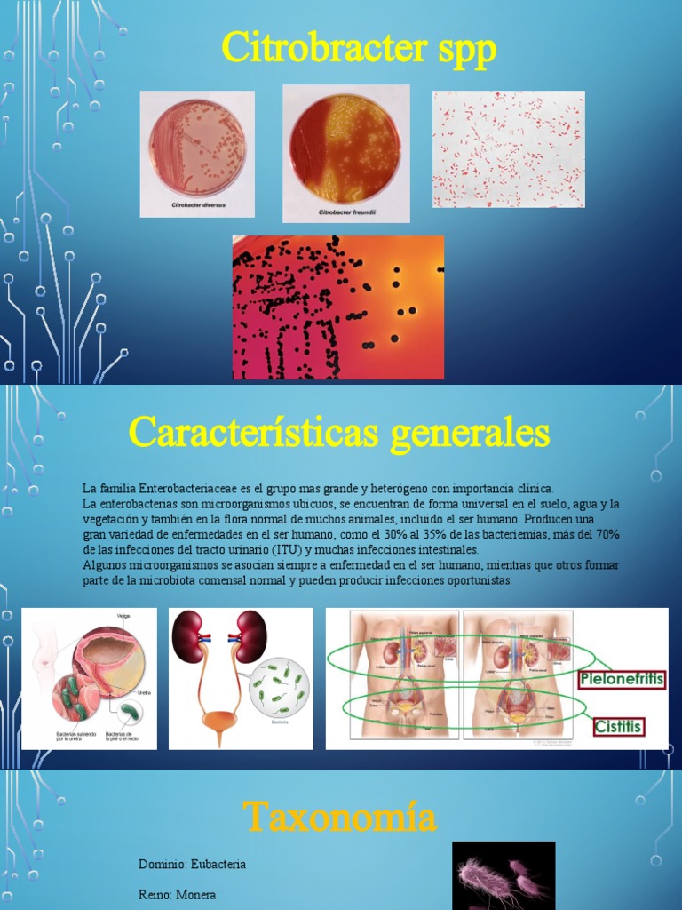 Citrobacter spp: Características y Patologías | PDF | Salud y bienestar ...