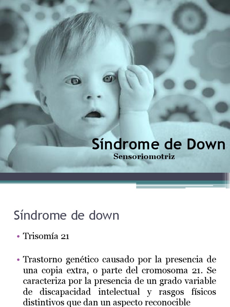 Síndrome de Down | PDF | Síndrome de Down | Enfermedades y trastornos