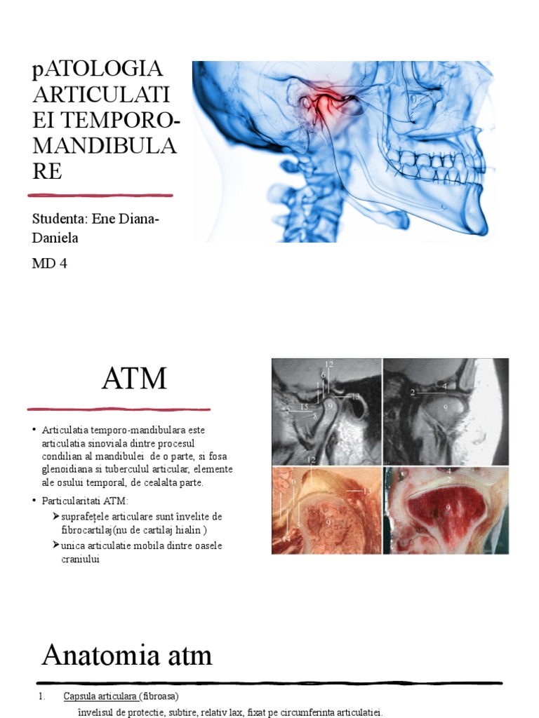 Patologia Atm | PDF