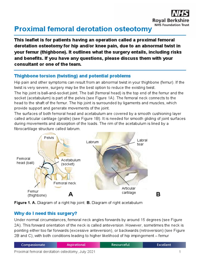 Proximal Femoral Derotation Osteotomy - Jul21 | PDF