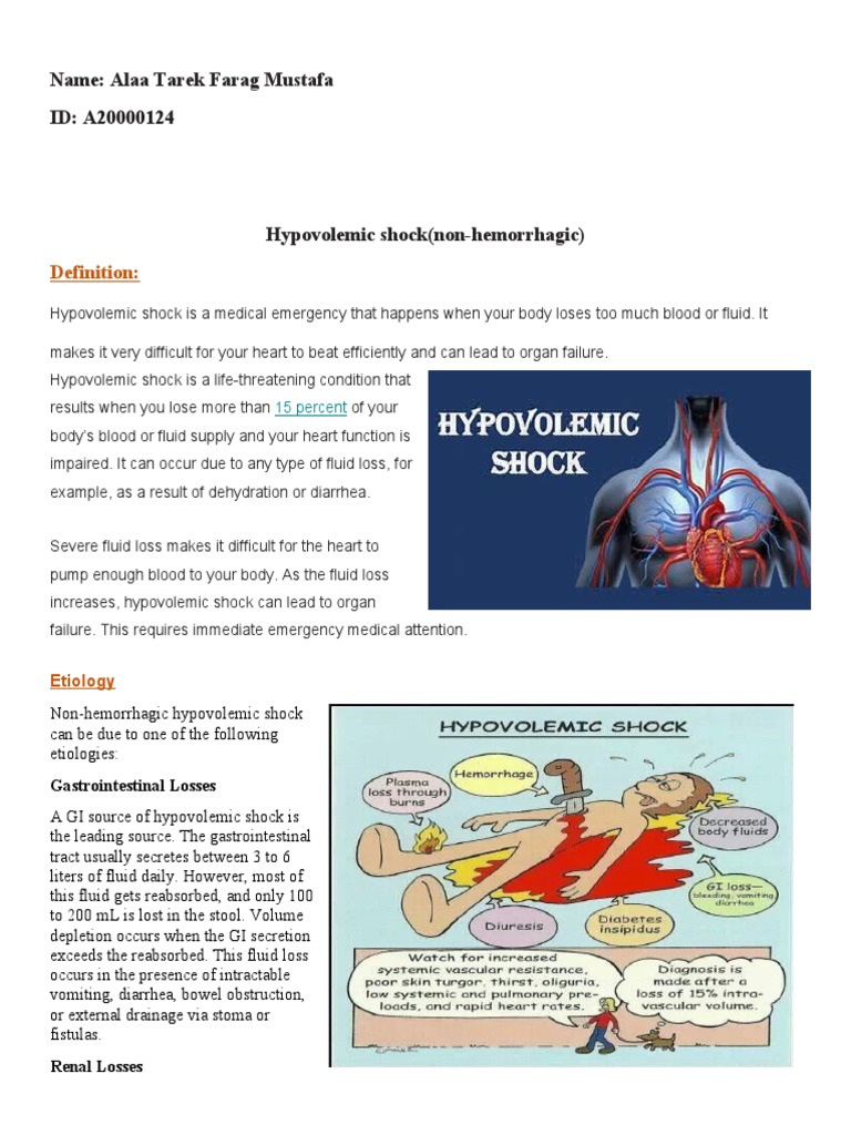 Hypovolemic Shock | PDF | Shock (Circulatory) | Blood Pressure