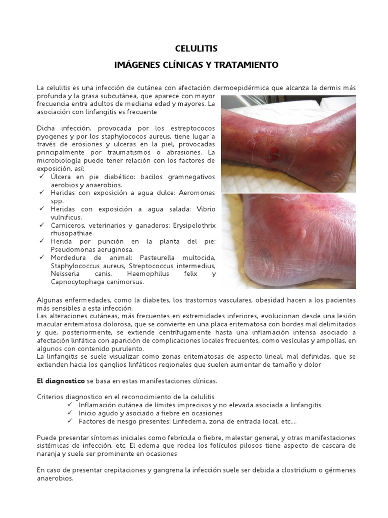 celulitis-imagenes-y-tratamiento | PDF | Especialidades Medicas | Enfermedades y trastornos
