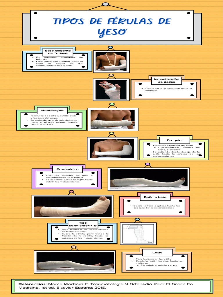 Infografía Tipos de Férulas | PDF | Codo | Rodilla
