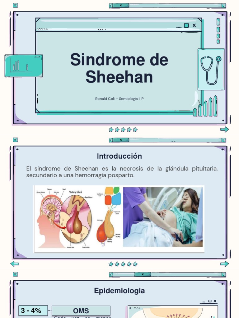 Sindrome de Sheehan - Expo Semiologia | PDF | Hipoglucemia | Periodo ...