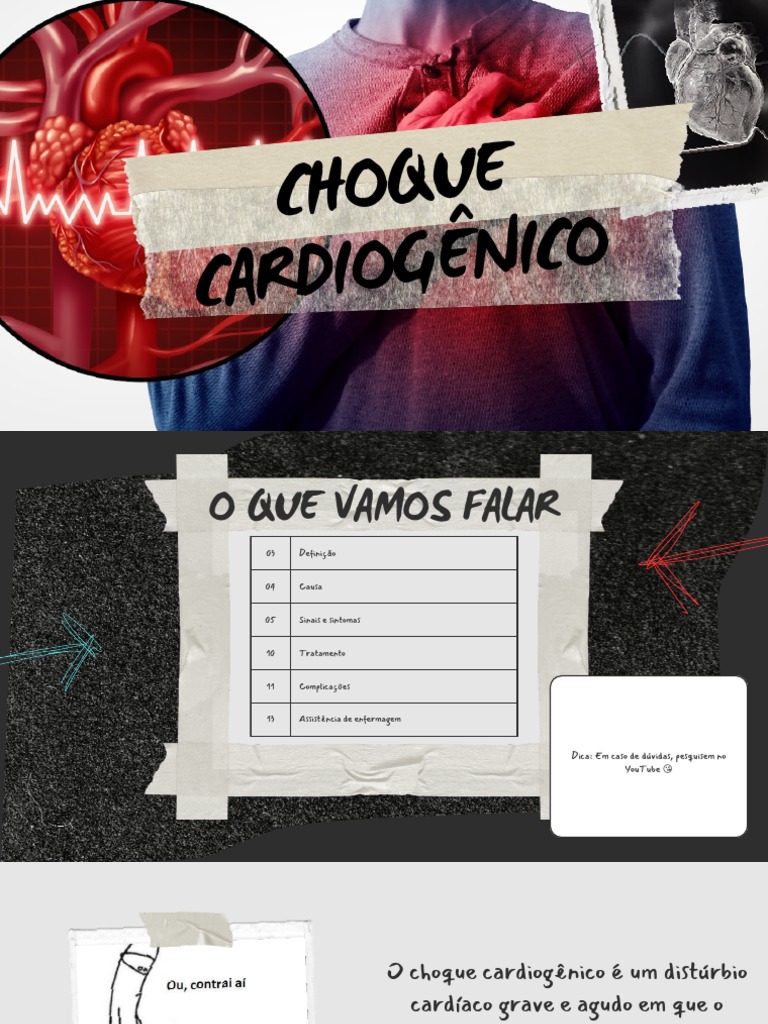 Choque Cardiogênico PDF | PDF