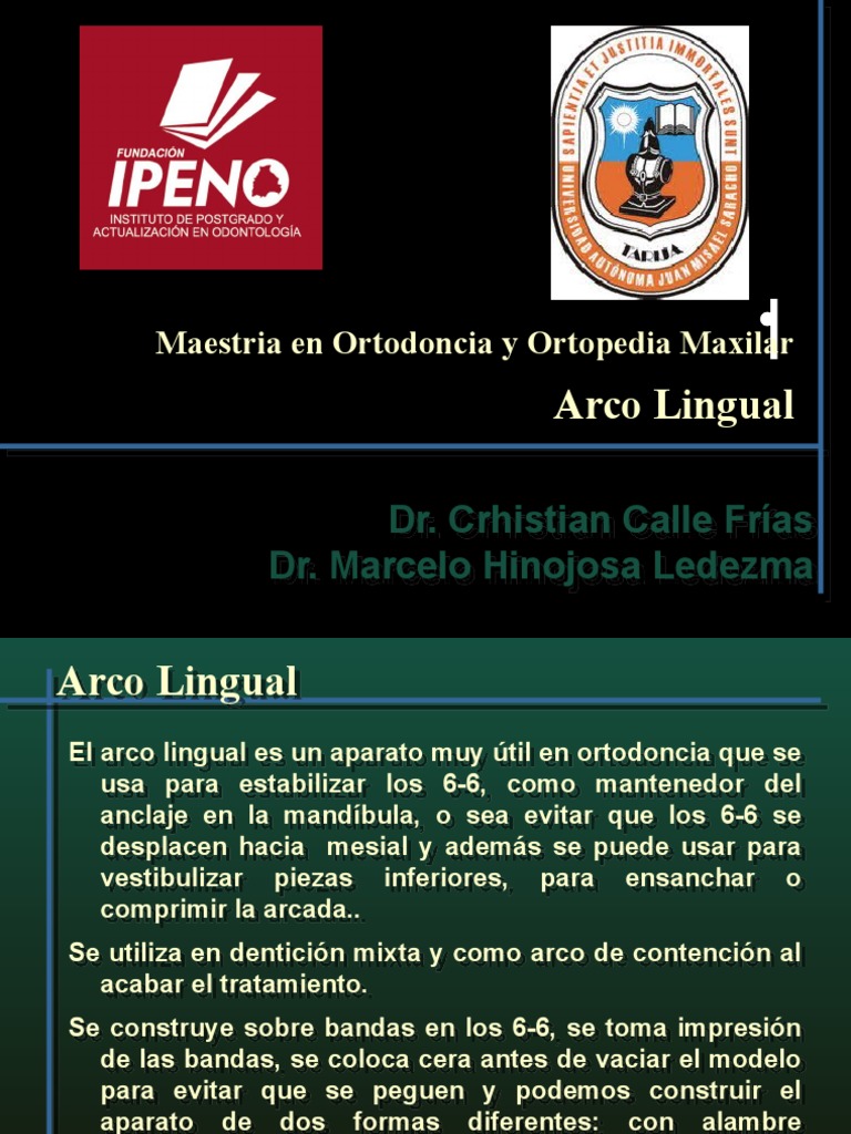 Arco Lingual en Ortodoncia: Usos y Ventajas | PDF | Ortodoncia | Diente
