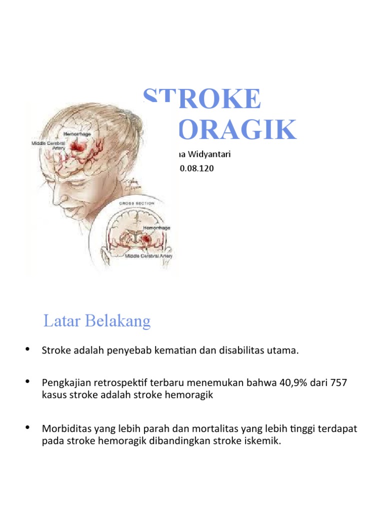 Stroke Hemoragik | PDF