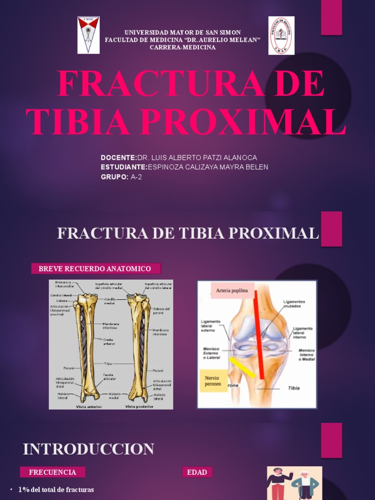 Fractura de Tibia | PDF