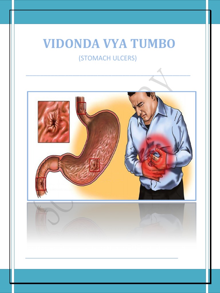 Vidonda Vya Tumbo-001 | PDF
