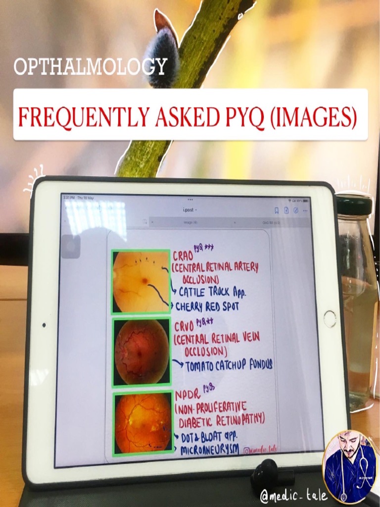 Optha. Pyq Images | PDF