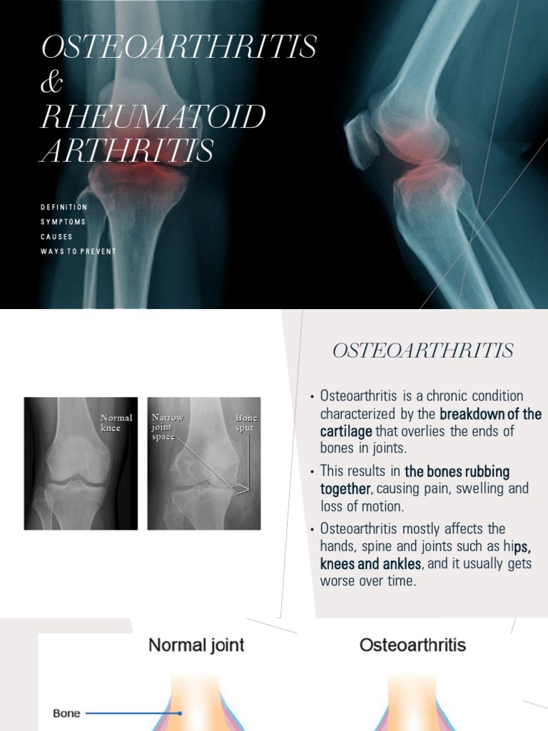 Osteoarthritis And Rheumatoid Arthritis Pdf
