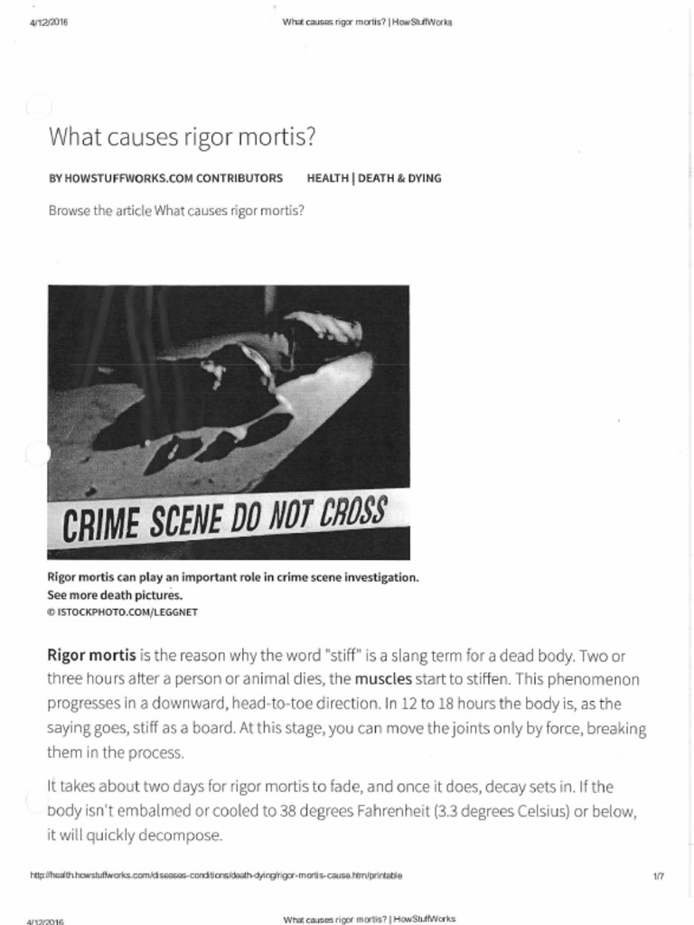 Kami Export - Anmol Patel - What Causes Rigor Mortis | PDF | Skeletal ...