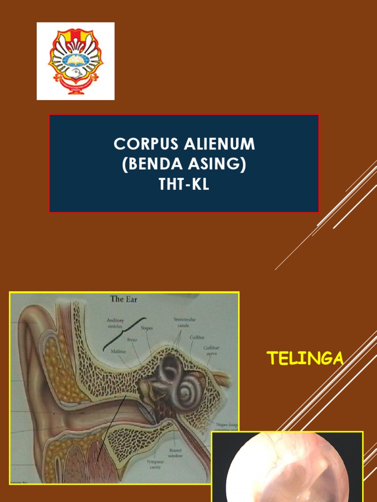 Corpus alienum THTKL dan epistaksis | PDF