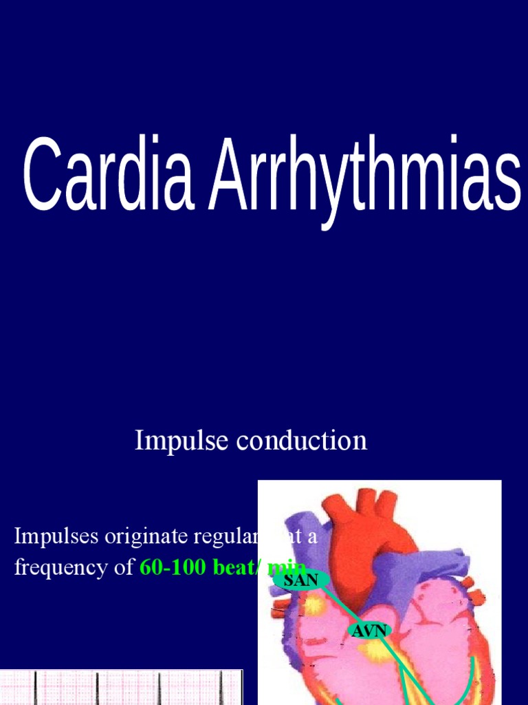 Prof. Randa Cardiac Arrhythmias | PDF | Internal Medicine ...