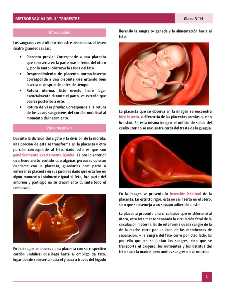 Metrorragia Del 3er Trimestre | PDF | Placenta | Parto