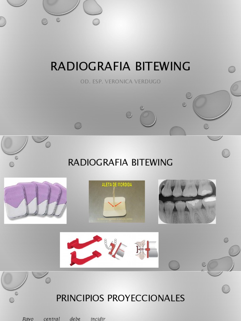 Técnicas de Radiografía Bitewing | PDF