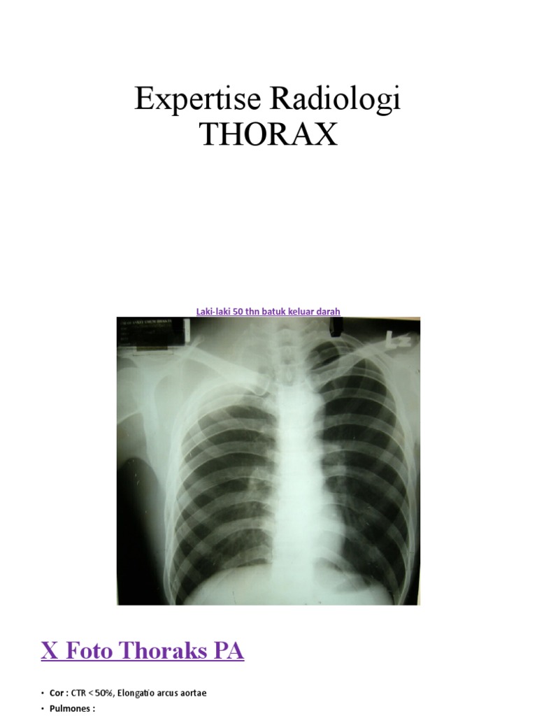 Expertise Radiologi Thorax | PDF