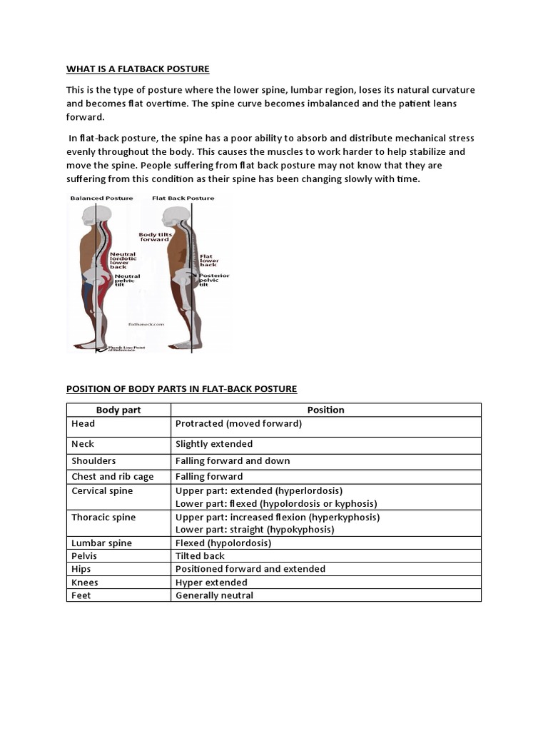 Flat-Back Posture | PDF