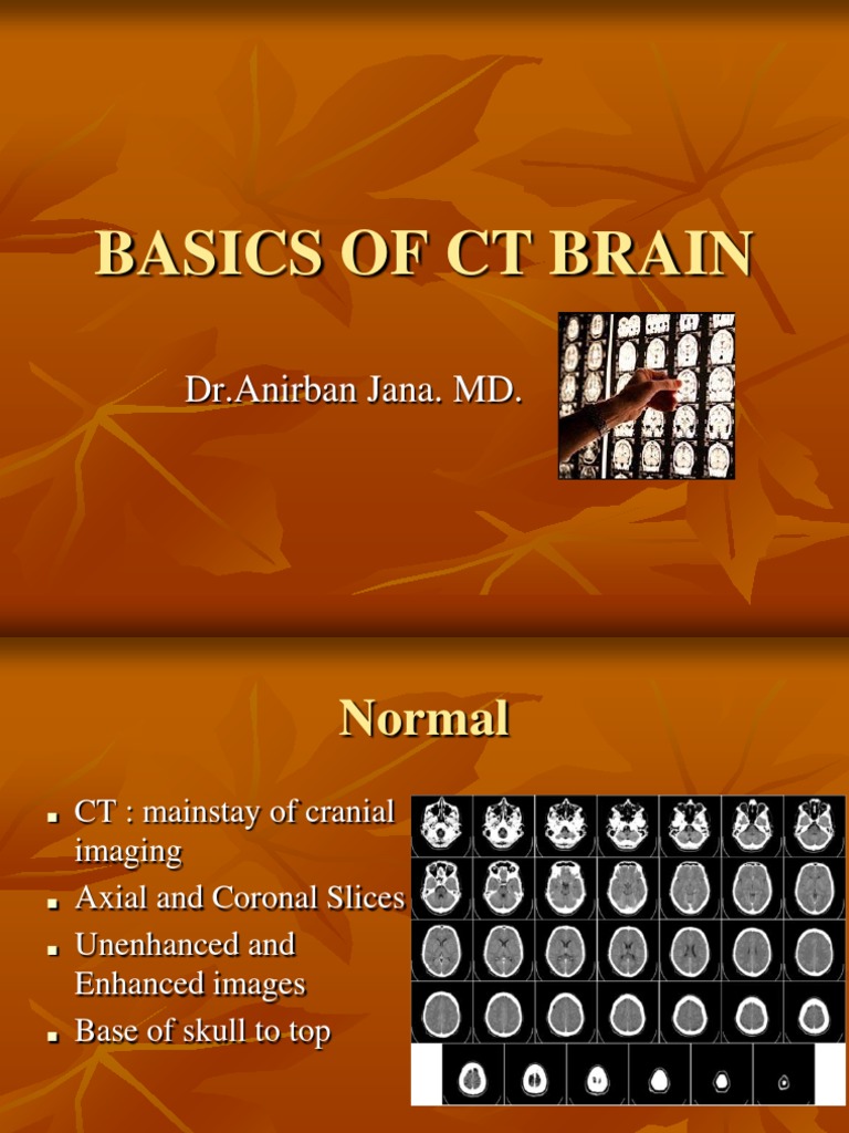 BASICS OF CT BRAIN (Practical) | PDF