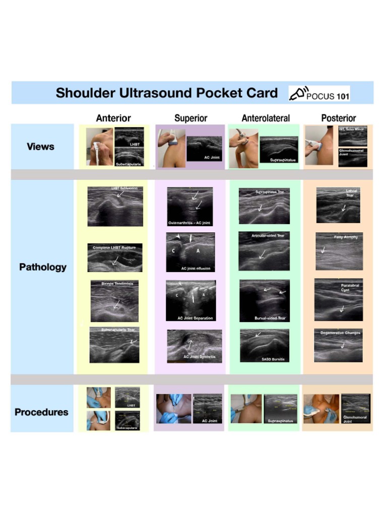 Shoulder Ultrasound Pocket Card PDF POCUS 101 | PDF