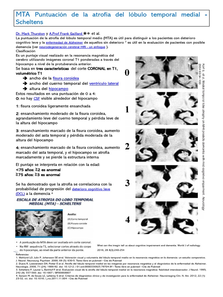 RMI Neurodegenerativas Consul | PDF