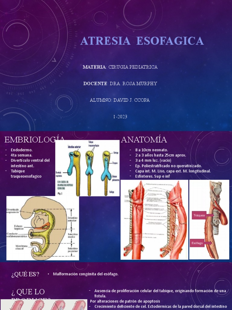 ATRESIA ESOFAGICA | PDF