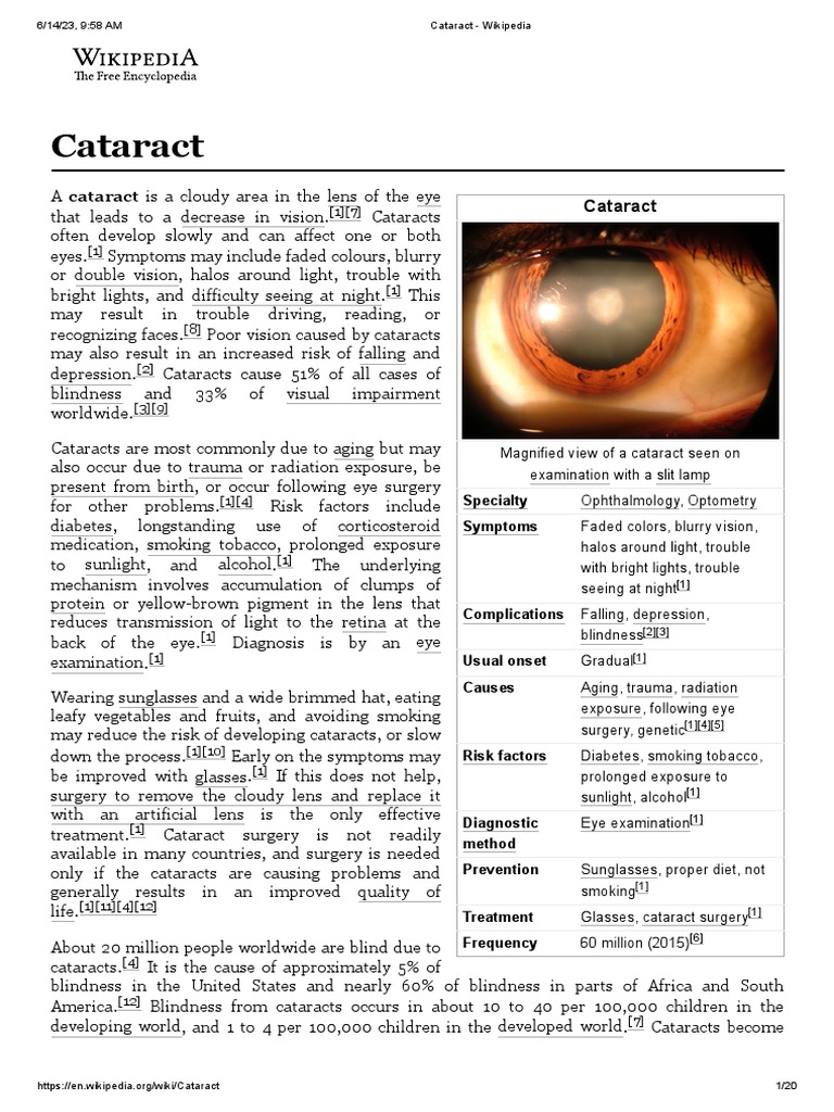 Cataract - Wikipedia | PDF | Science & Mathematics
