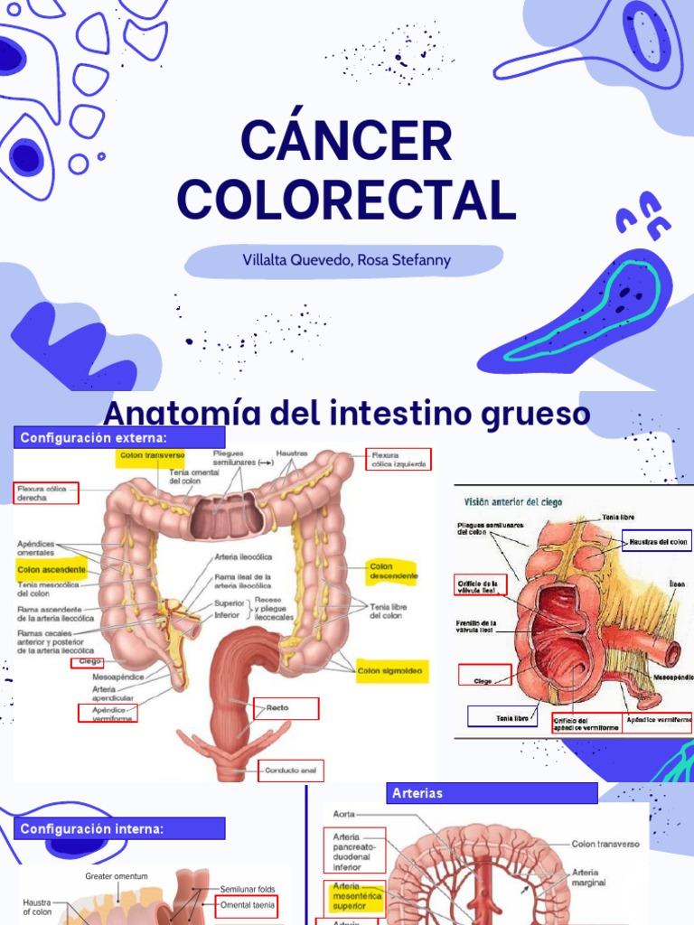 Cáncer Colorectal | PDF | Cáncer colonrectal | Epidemiología