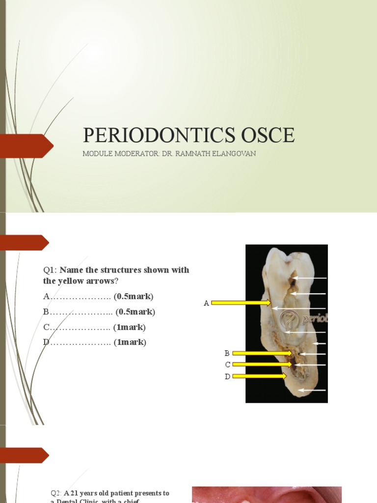 OSCE Periodontics | PDF