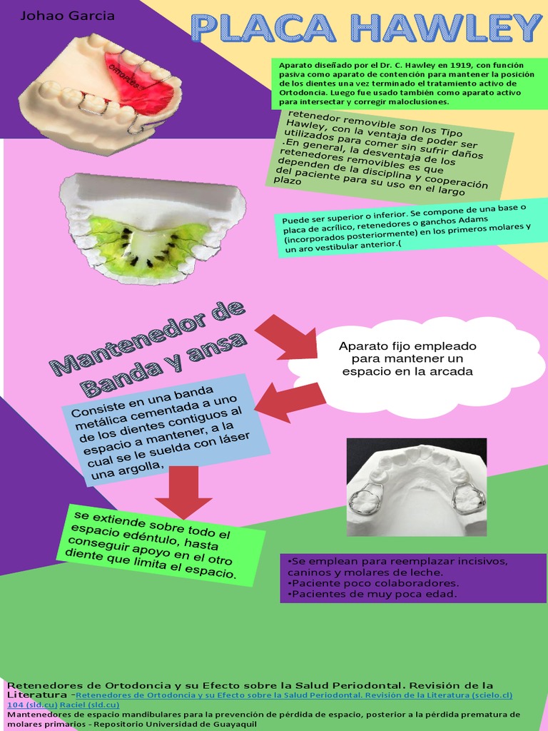Placa Hawley | PDF