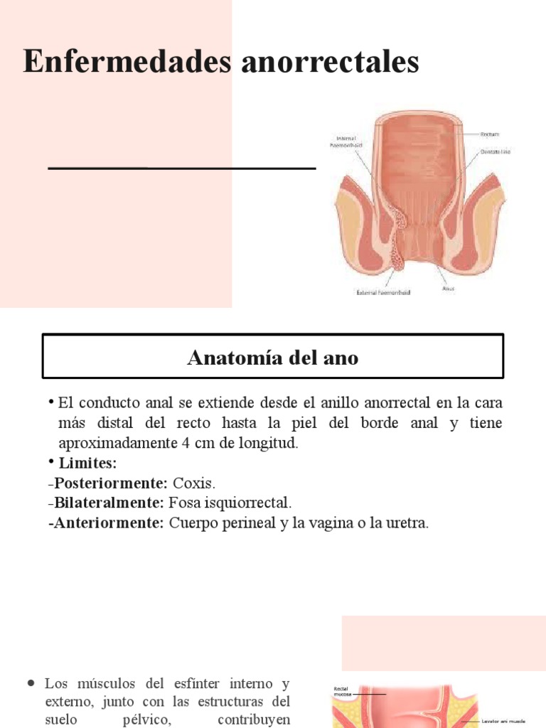 Enfermedades Ano Recto 2 | PDF | Hemorroides | Enfermedades y trastornos