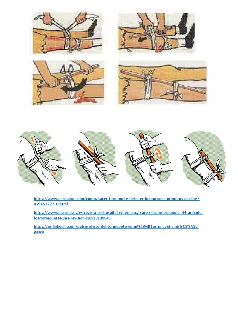 Cómo aplicar un torniquete en hemorragias | PDF