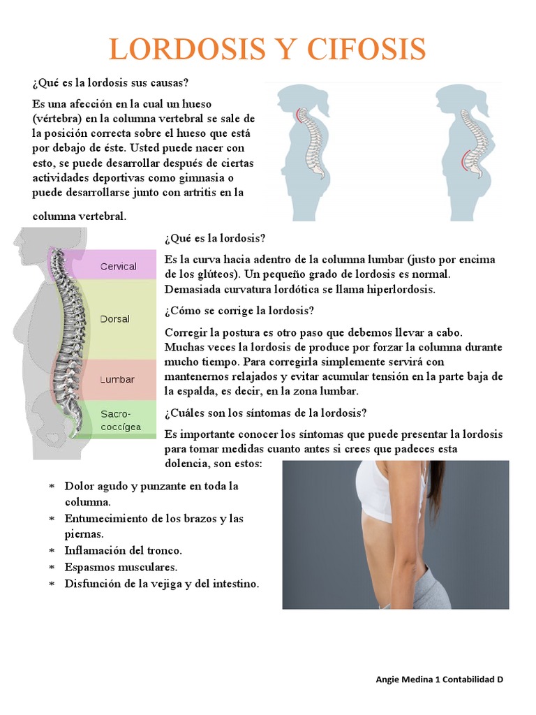 Lordosis y Cifosis | PDF | La columna vertebral | Medicina CLINICA