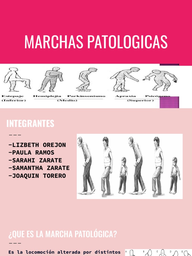 MARCHAS PATOLOGICAS (3) (1) | PDF