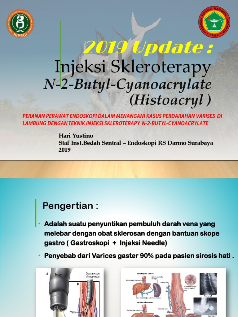 Injeksi Skleroterapy HistoAcryl | PDF