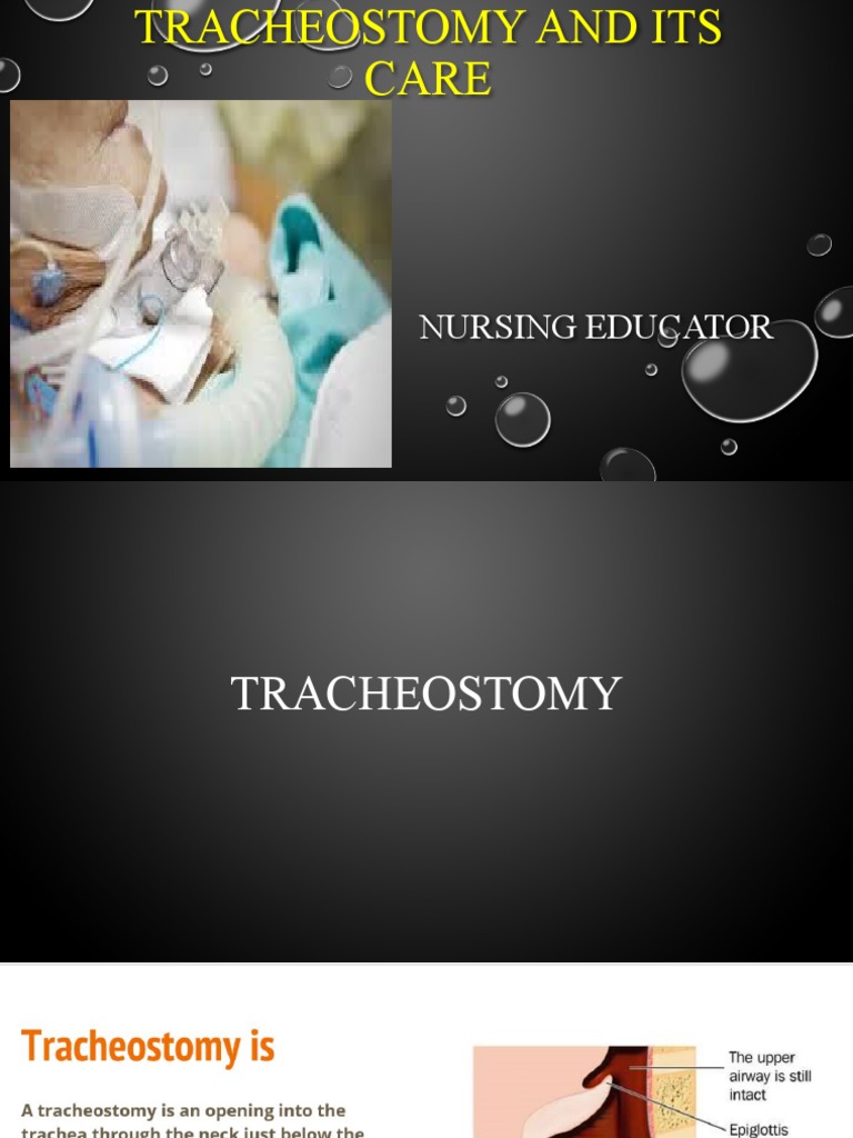 Tracheostomy Care Guidelines for Nurses | PDF | Wellness