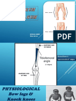 Mini Tightrope CMC Fixation | PDF | Thumb | Musculoskeletal System