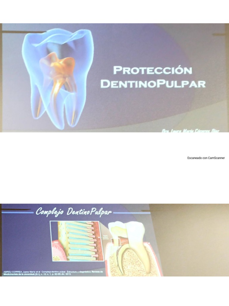 Operatoria. Protección Dentino Pulpar | PDF